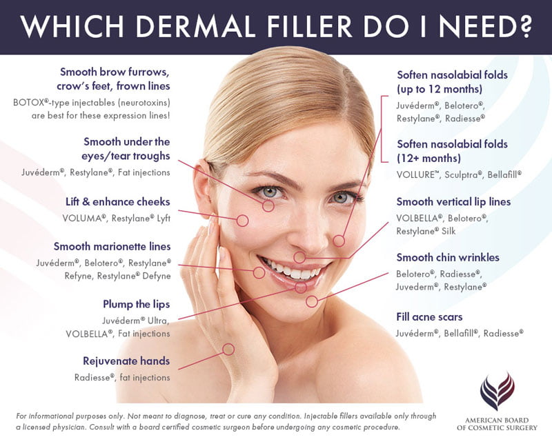 Types Of Dermal Fillers MLA Dermatology Santa Monica CA Types Of Dermal Fillers MLA Dermatology Santa Monica CA